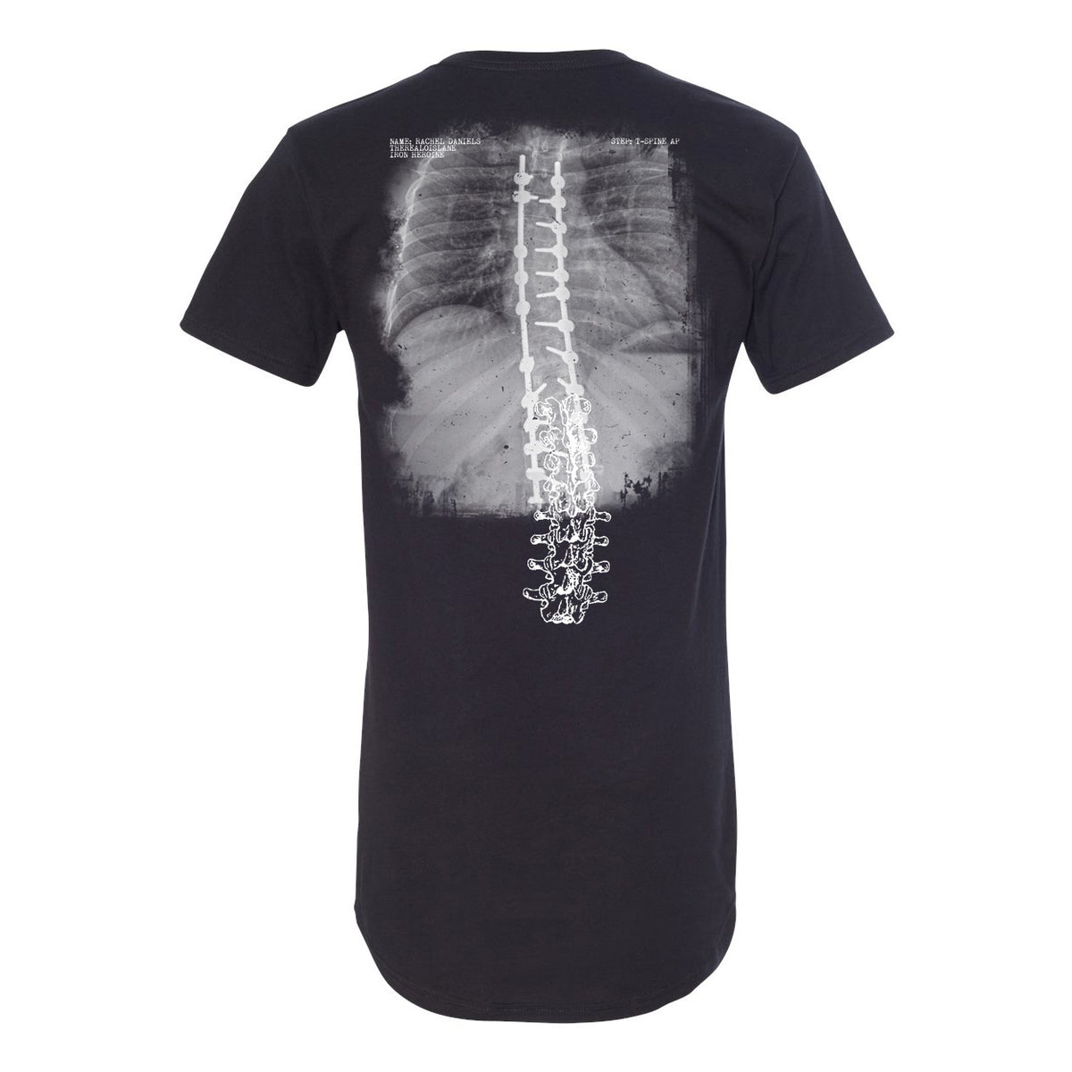 X-Ray Long Body Tee – Therealoislane